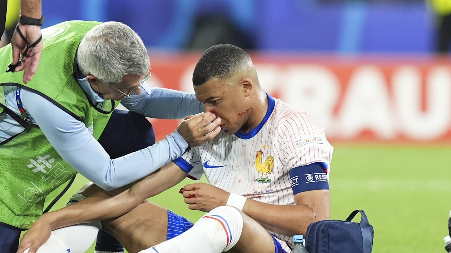 Menderita Patah Tulang Hidung, Apakah Kylian Mbappe Akan Absen dalam Sisa Euro 2024?