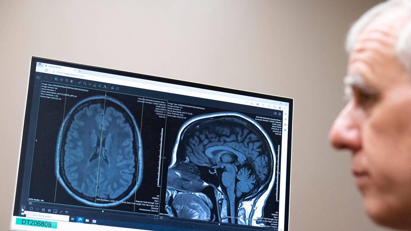NIH makes $15.3 million grant to help diagnose CTE in living football ...