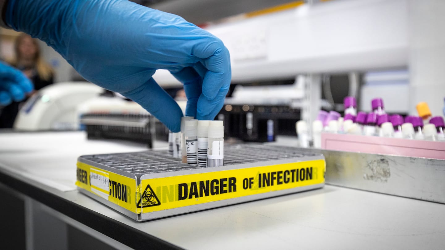 Understanding the Symptoms of Urinary Tract Infection