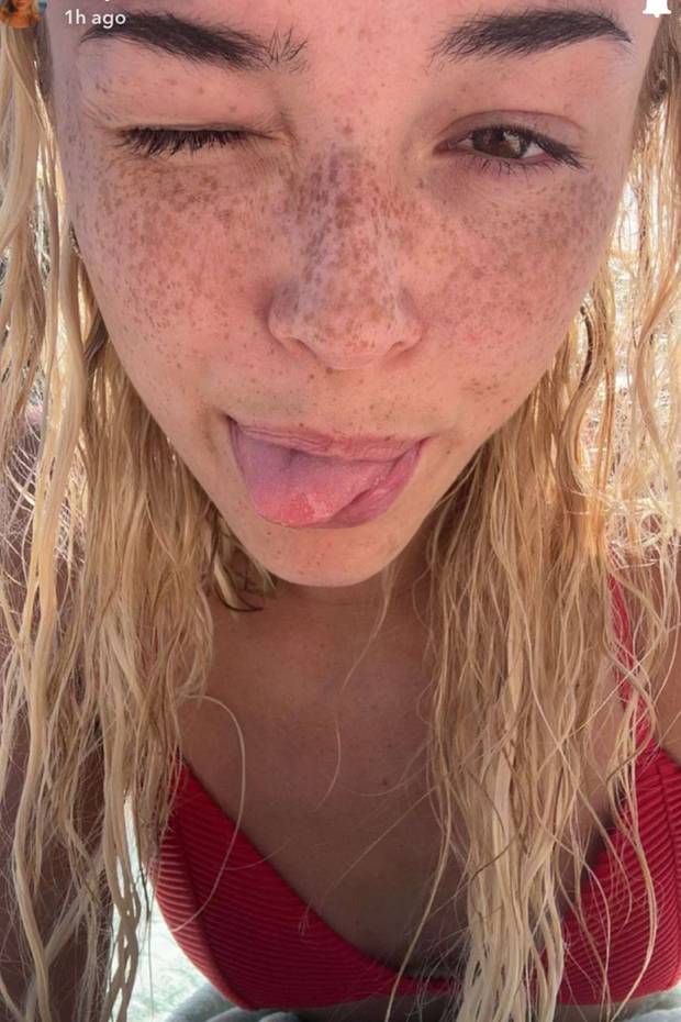 Livvy Dunne reveals lots of freckles in makeup-free selfie close-up