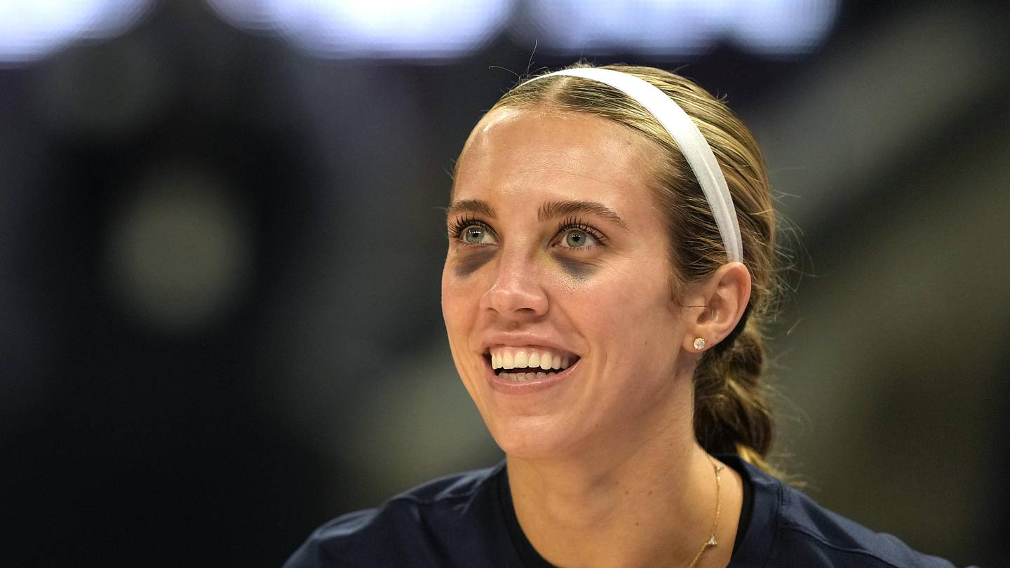 Lexie Hull Shares Indiana Fever Squad Black Eye Surprise