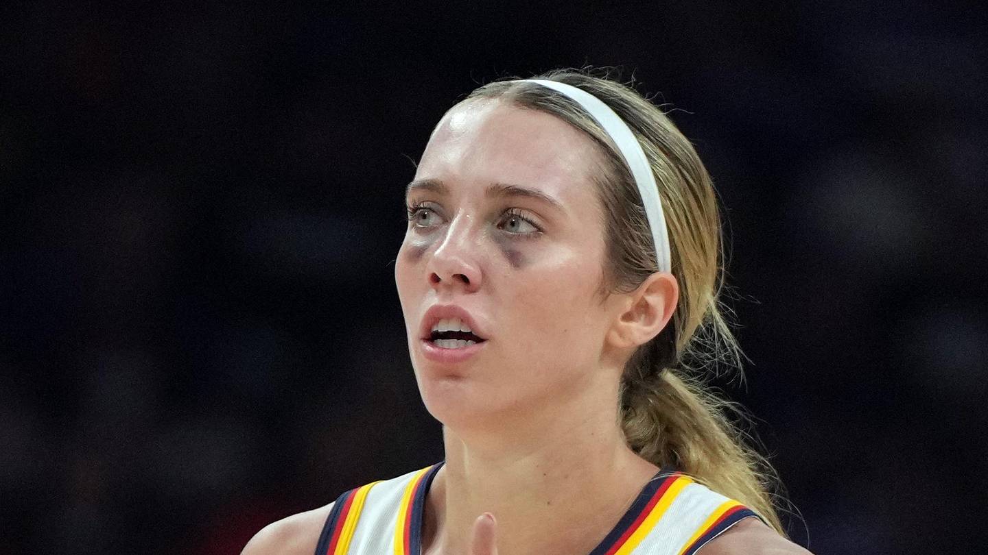 Fever star Lexie Hull turns two black eyes into matching fit fashion ...