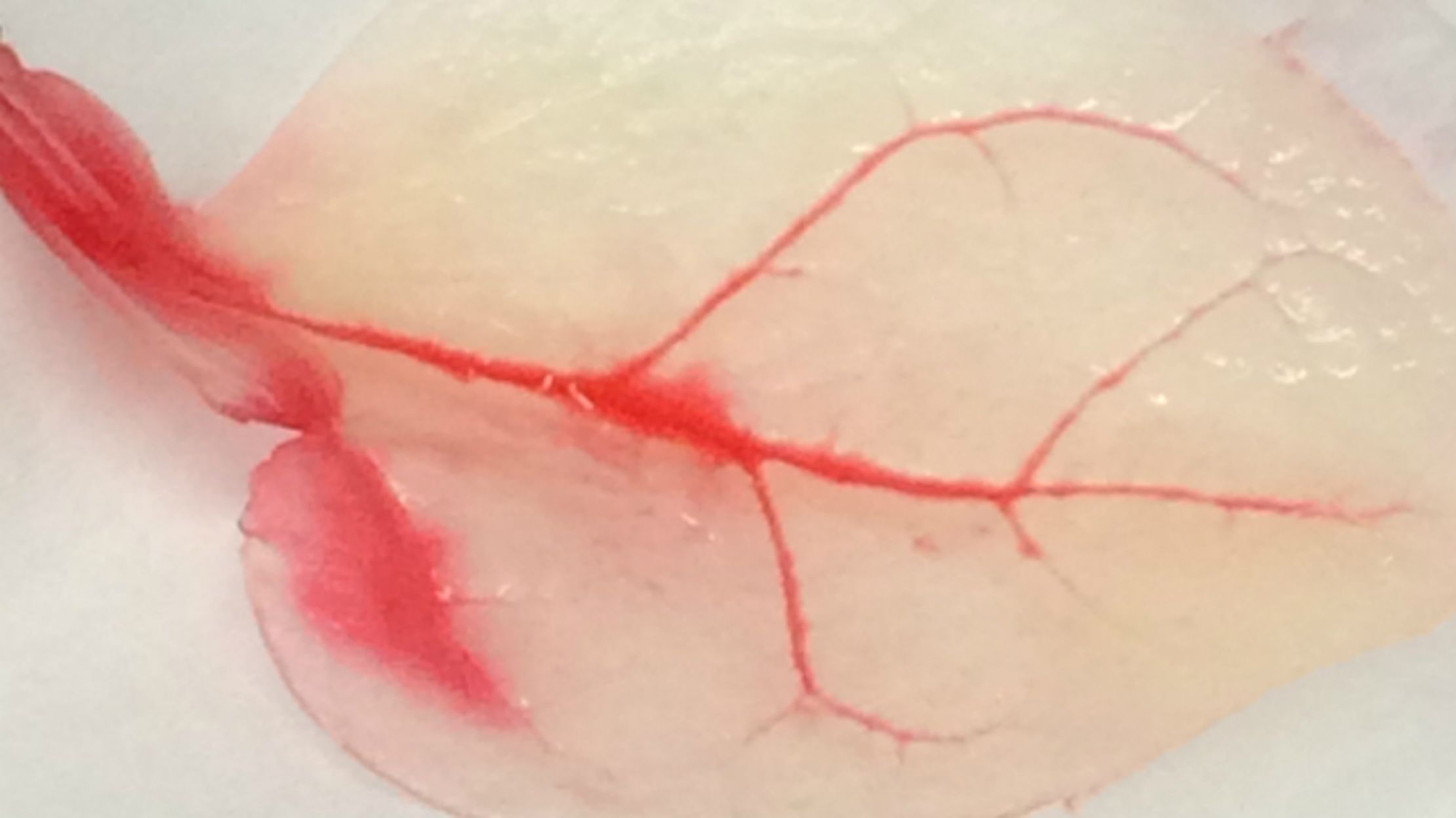 Scientists Grow Human Heart Cells in Spinach Leaves | Mental Floss Scientists Grow Human Heart Cells in Spinach Leaves | Mental Floss