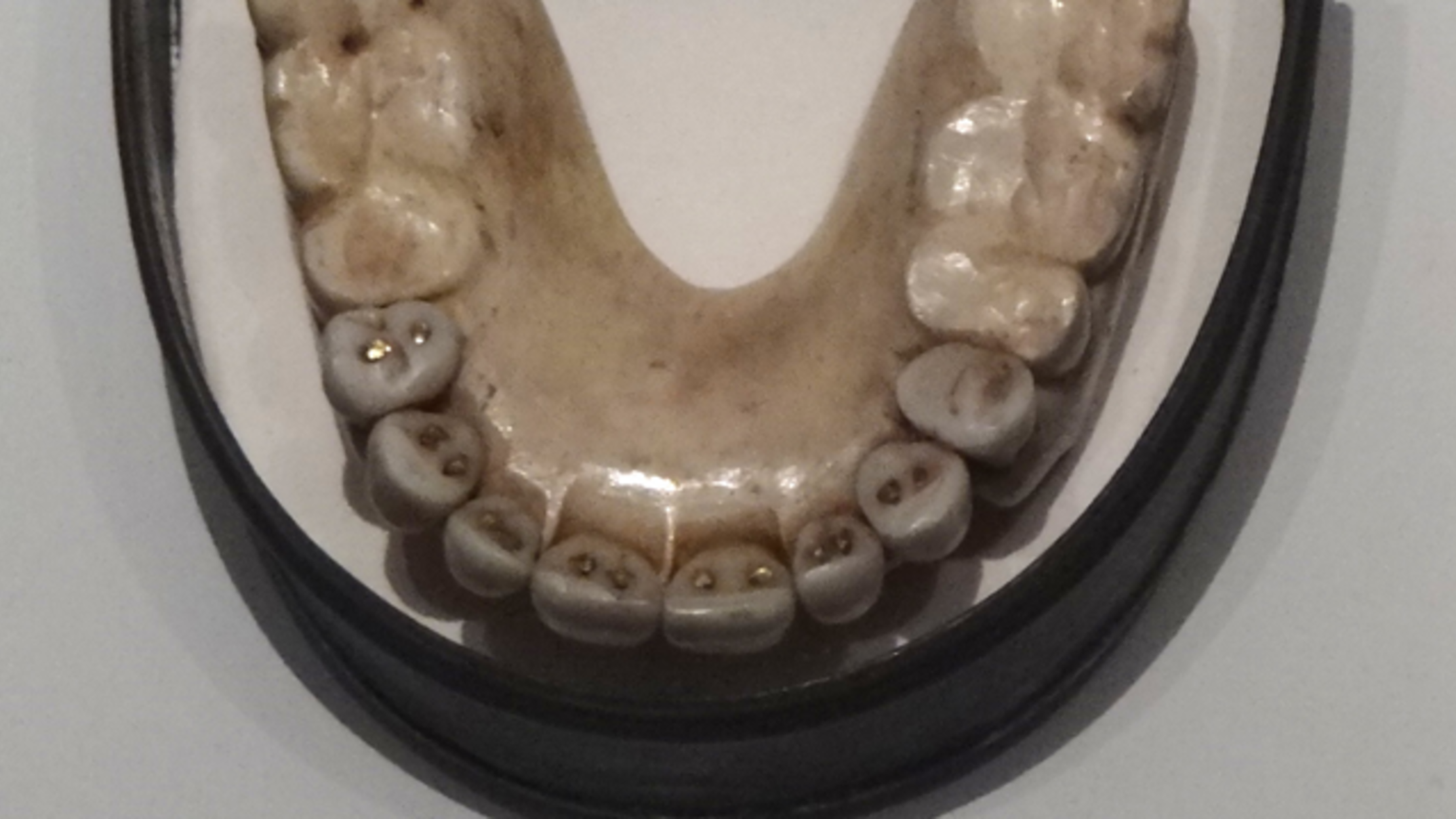 When Dentures Were Made From the Teeth of Dead Waterloo Soldiers ...