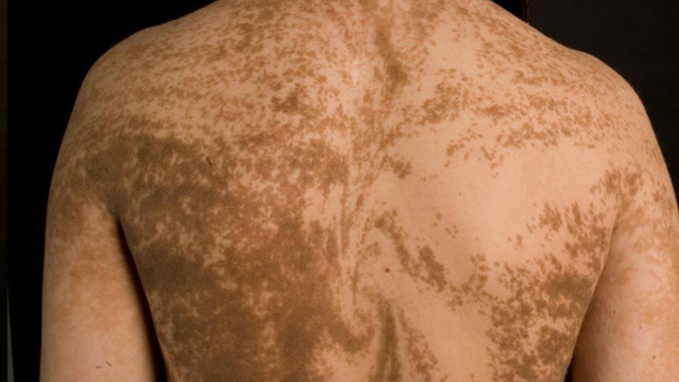 Our Skin Is Covered With Invisible Stripes Mental Floss Our Skin Is Covered With Invisible Stripes Mental Floss