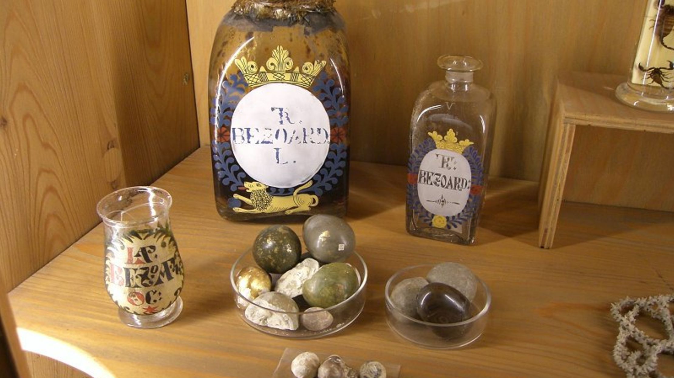 4 Types of Stones That Could Be Inside Your Body | Mental Floss