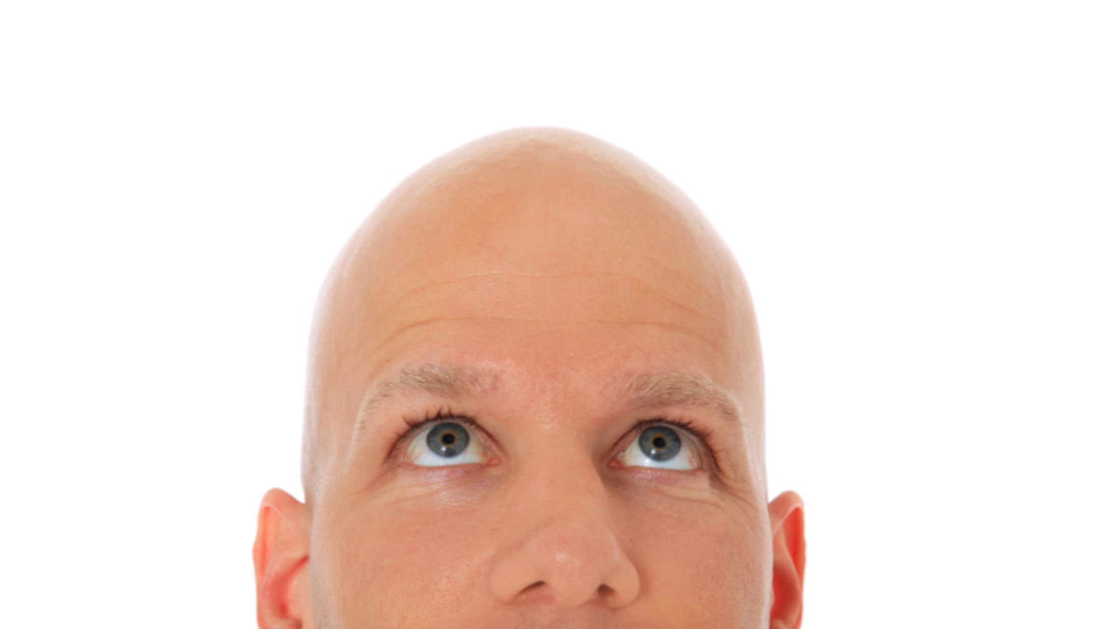 14 of History’s Craziest Baldness Cures | Mental Floss