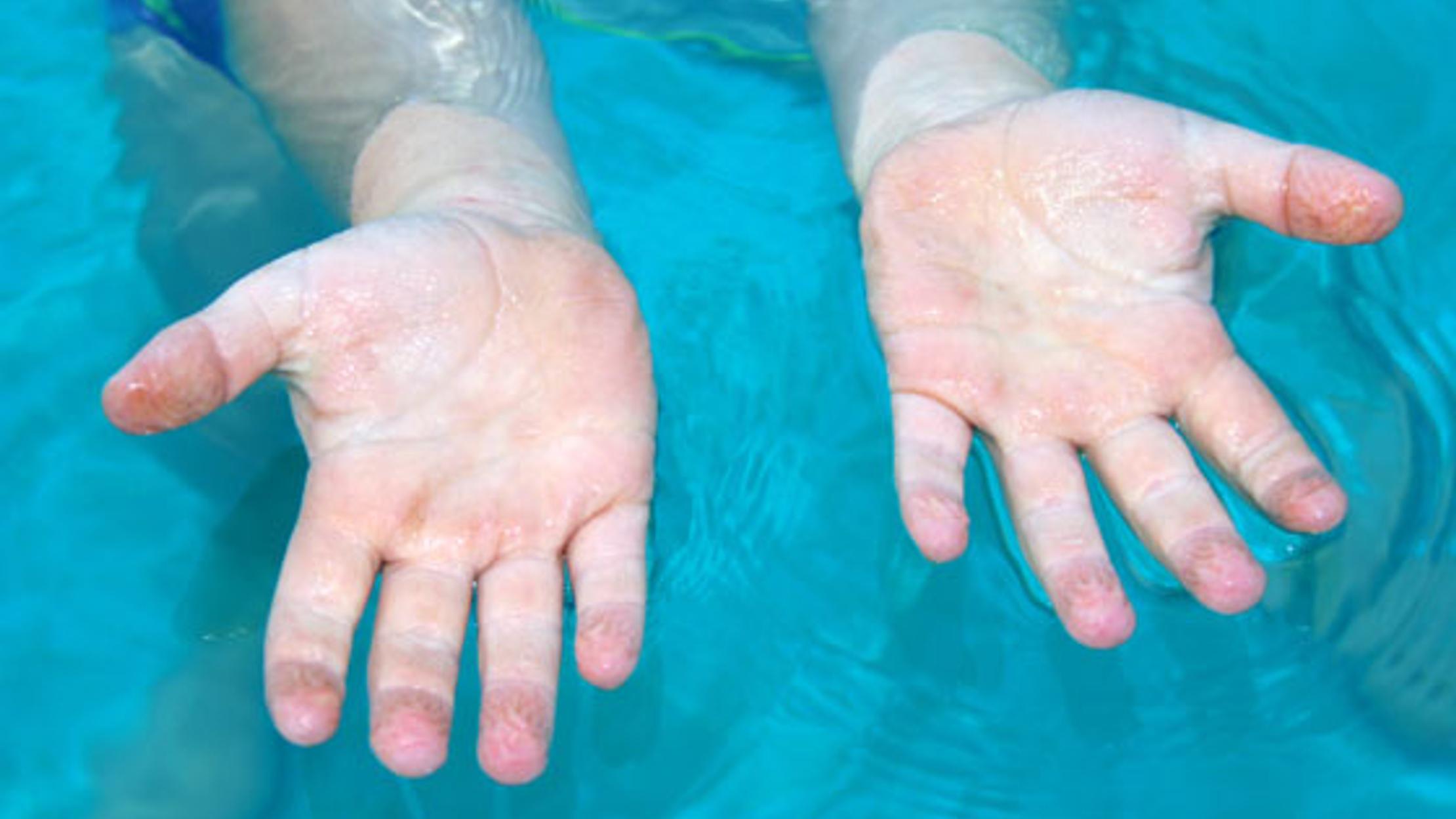 Why Does Skin Get Pruney In The Tub Mental Floss Why Does Skin Get Pruney In The Tub Mental Floss