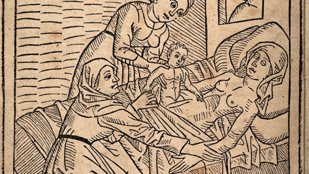 cesarean section name origin